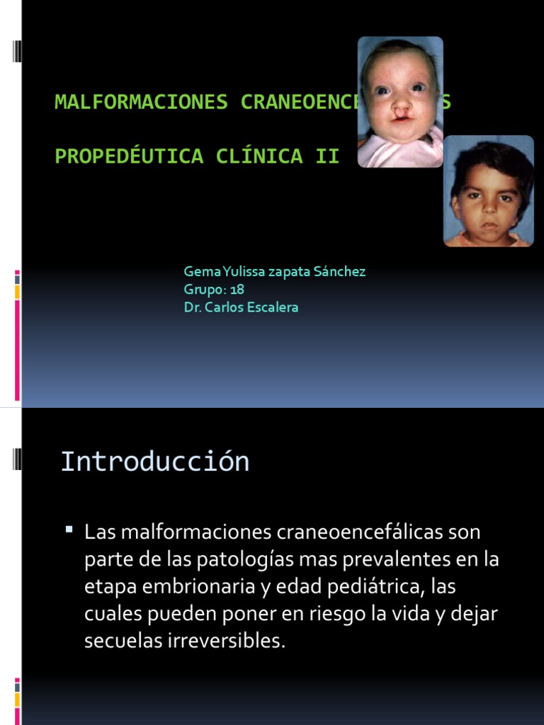 Malformaciones Craneoencefálica | PDF | Enfermedades y trastornos | Especialidades Medicas