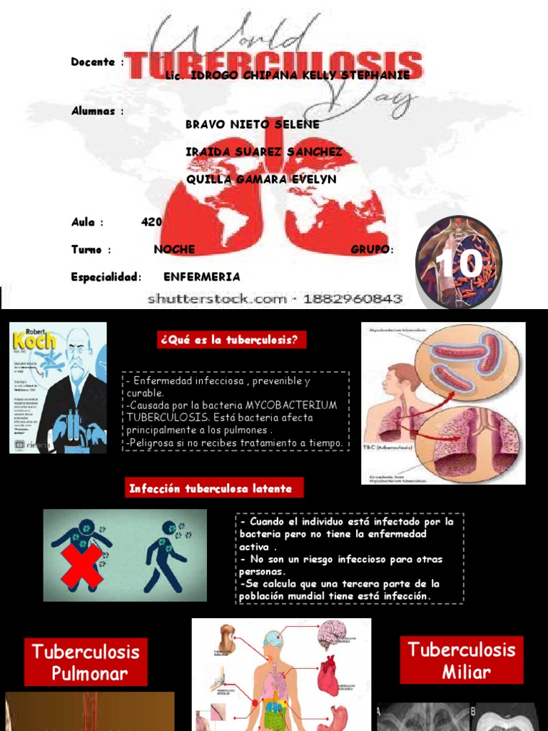 Exposición TBC (Final) | PDF | Tuberculosis | Medicina CLINICA