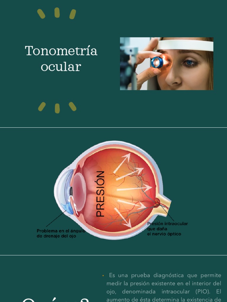 Tonometria Ocular | PDF