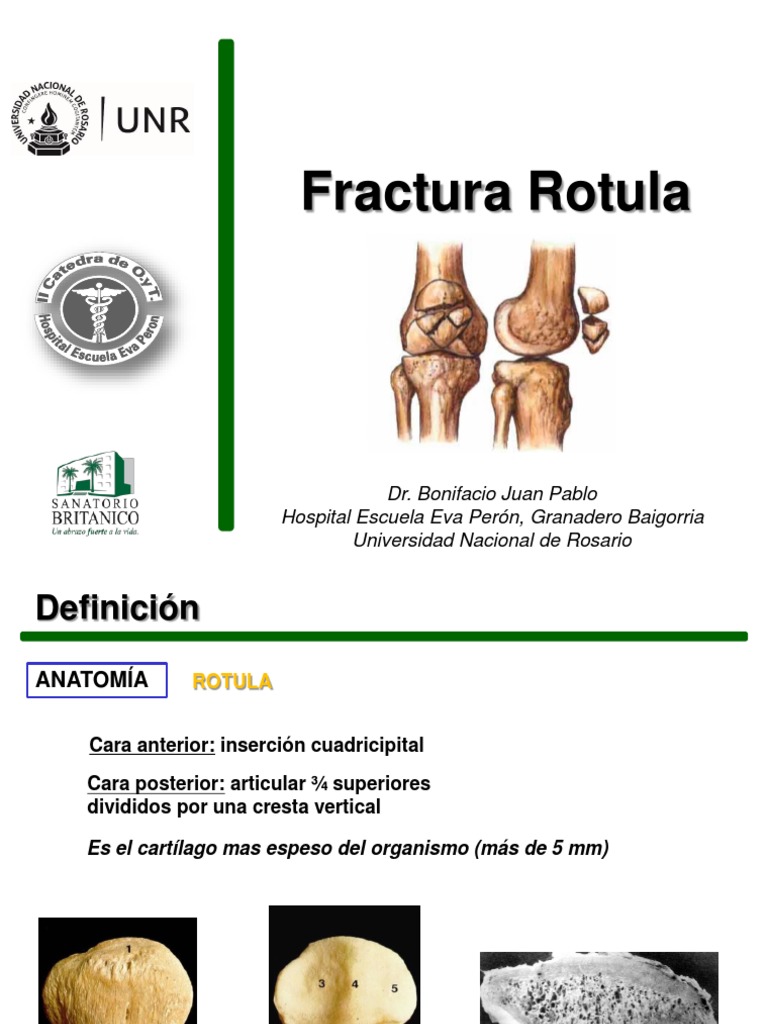 Fractura Rotula Pregrado PDF | PDF | Lesión | Medicina