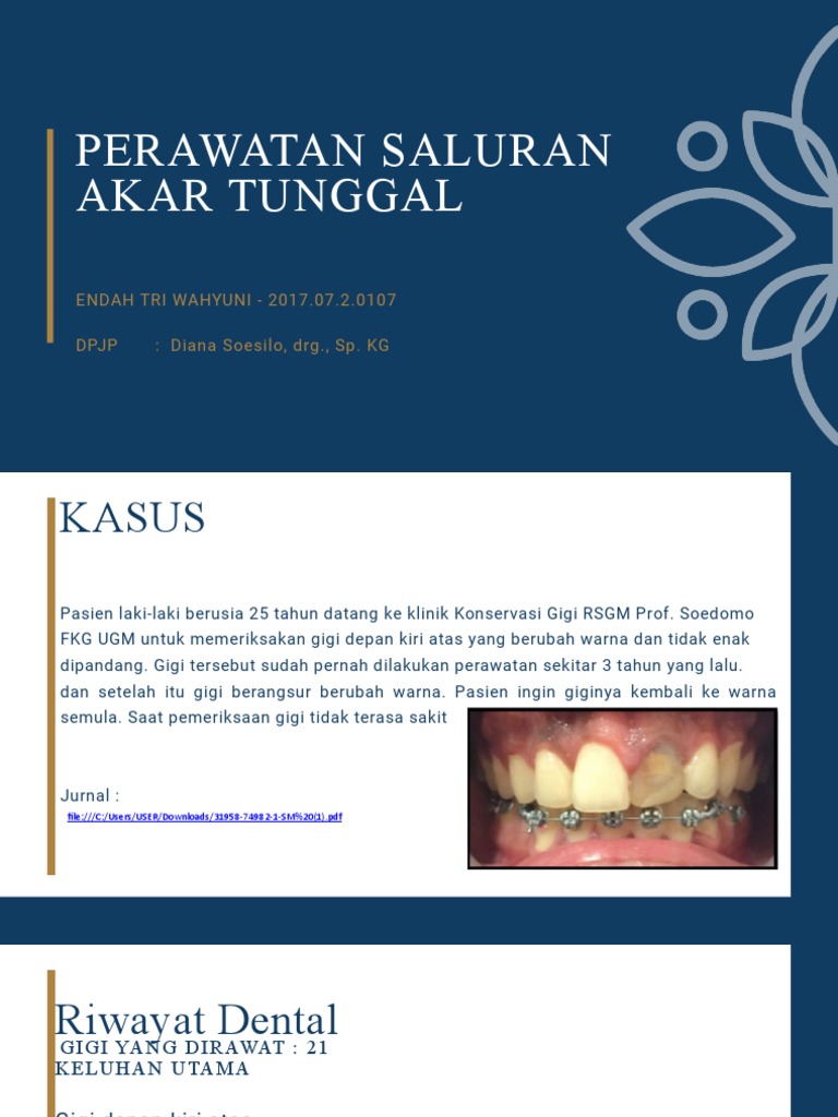 Perawatan Saluran Akar Tunggal | PDF