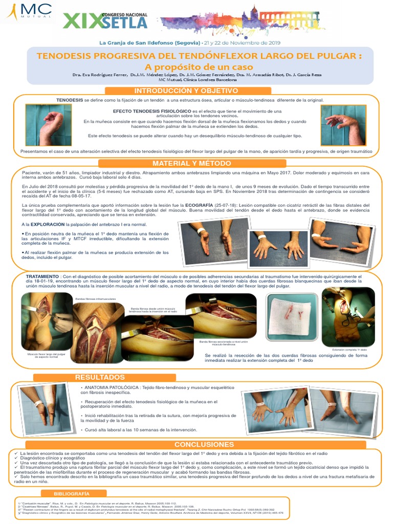 Tenodesis Progresiva del Pulgar | PDF | Mano | Músculo