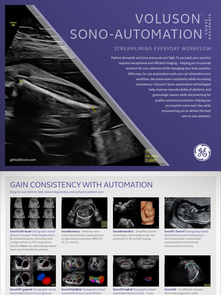 2018 - Voluson Signature Series BT18 - SonoAutomation - JB55327XXai ...