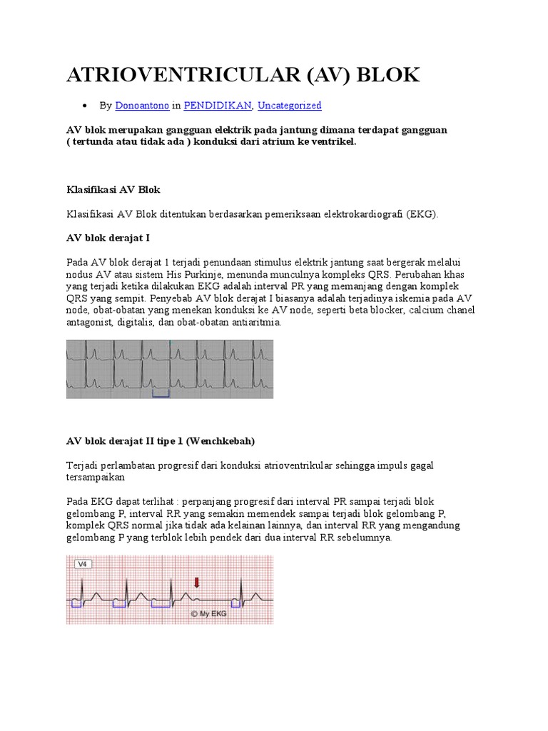 ATRIOVENTRICULAR | PDF | Sains & Matematika