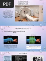 Pitch y TC Helicoidal | PDF | Ct Scan