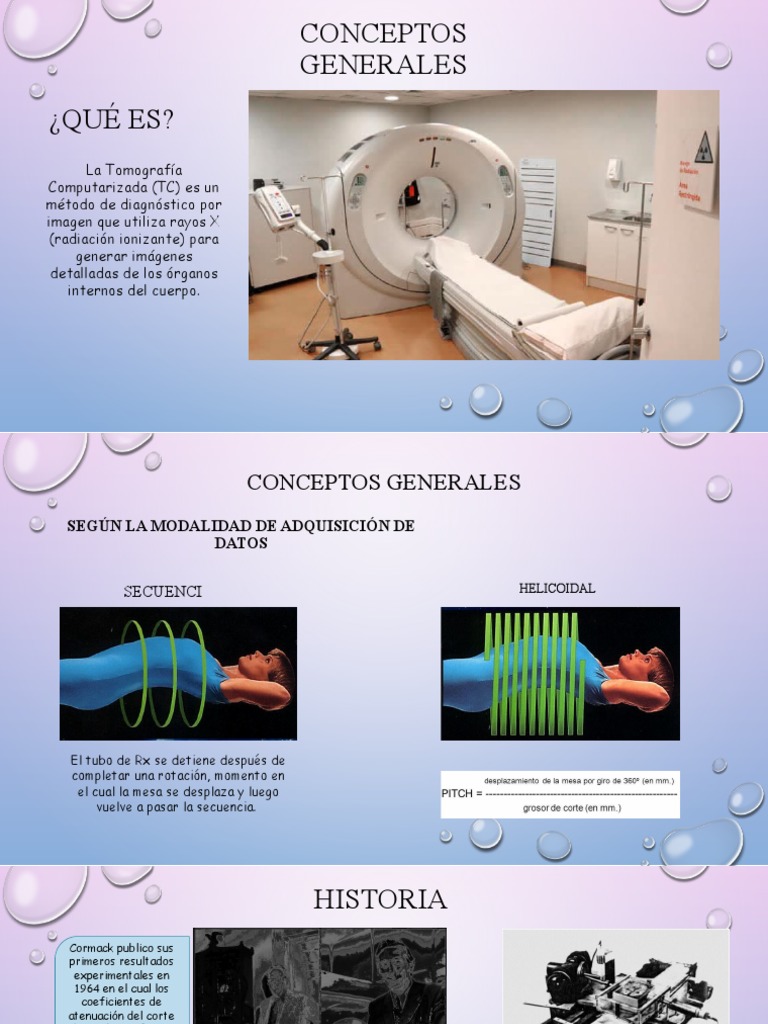 Tipos y Generaciones de Tomografía | PDF | Ct Scan | Radiación