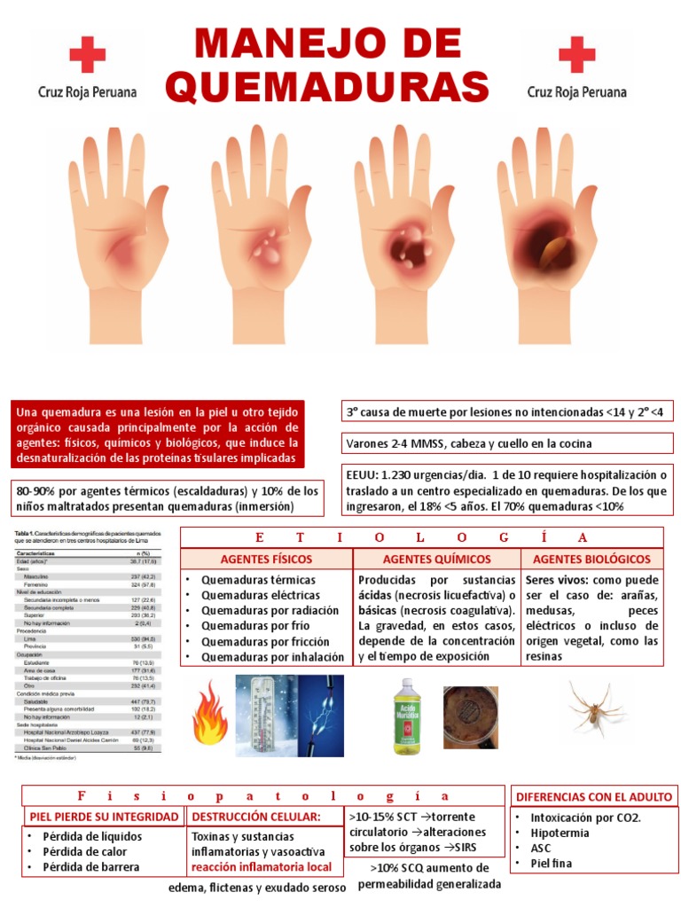 Manejo de Quemaduras | PDF | Quemar | Medicina