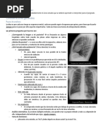 Niveles Axilares de Berg | PDF | Finanzas y administración del dinero