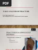 PTTI: Adult Flatfoot Insights | PDF | Foot | Ankle