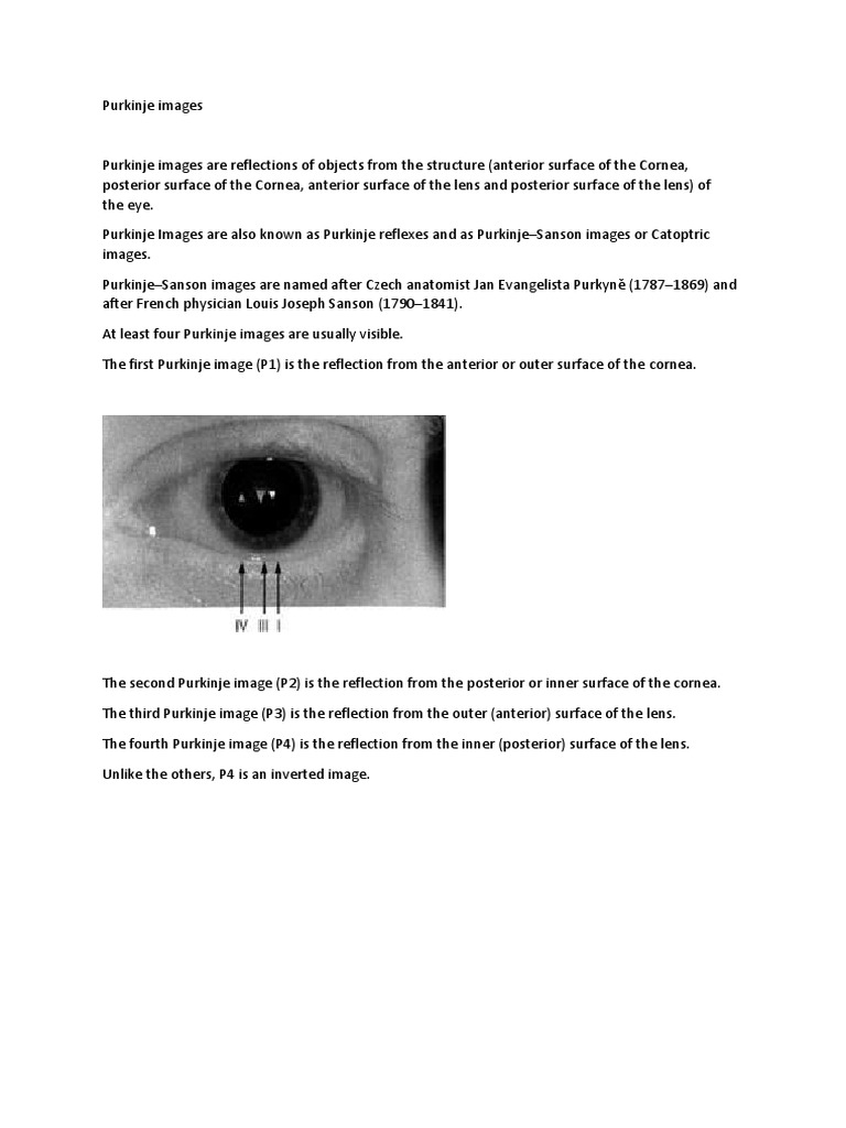 An Overview of Purkinje Images: Their Formation, Clinical Uses, and ...