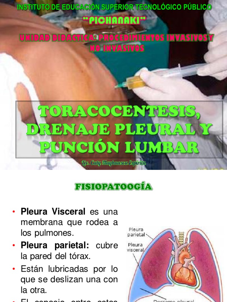 Toracocentesis | PDF | Enfermedades y trastornos | Medicina
