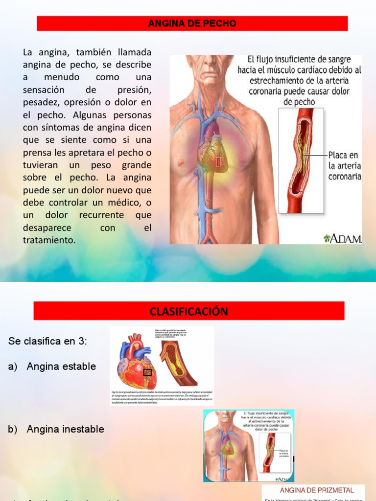 Exposición Angina de Pecho | PDF | Medicina CLINICA | Especialidades ...