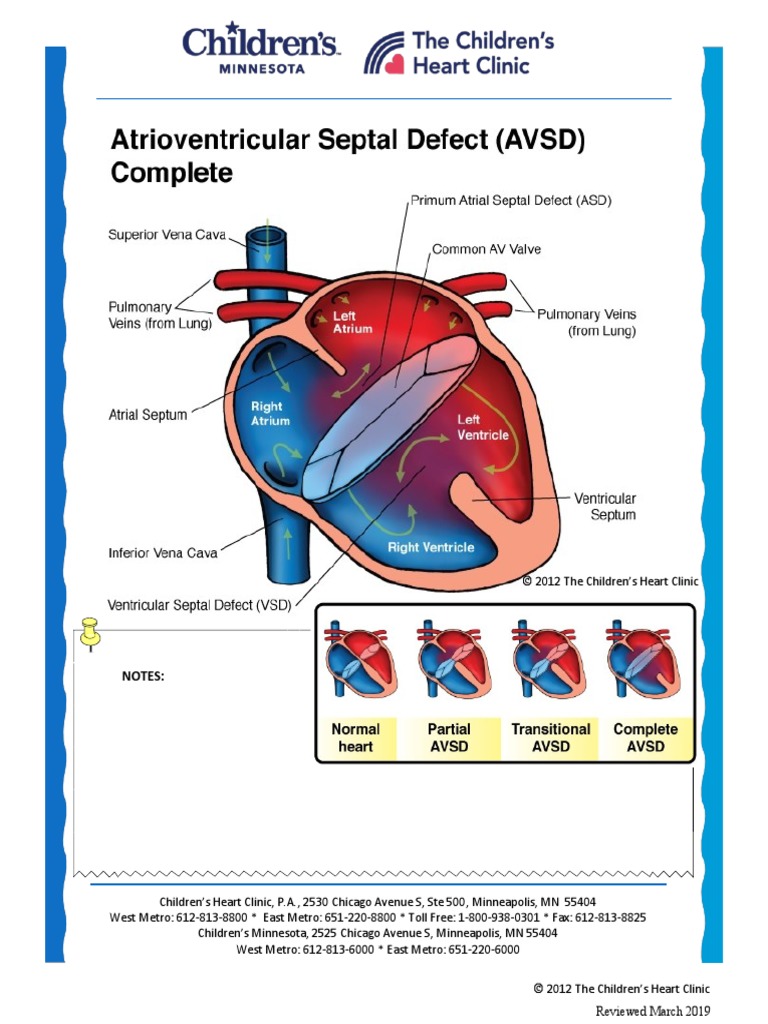 Atrioventricular Septal Defect Avsd Complete | PDF | Heart Valve ...