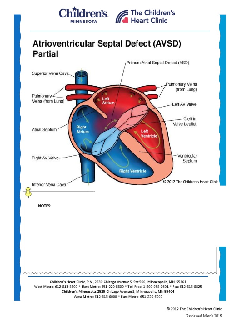 Atrioventricular Spetal Defect Avsd Partial Edit | PDF | Congenital ...