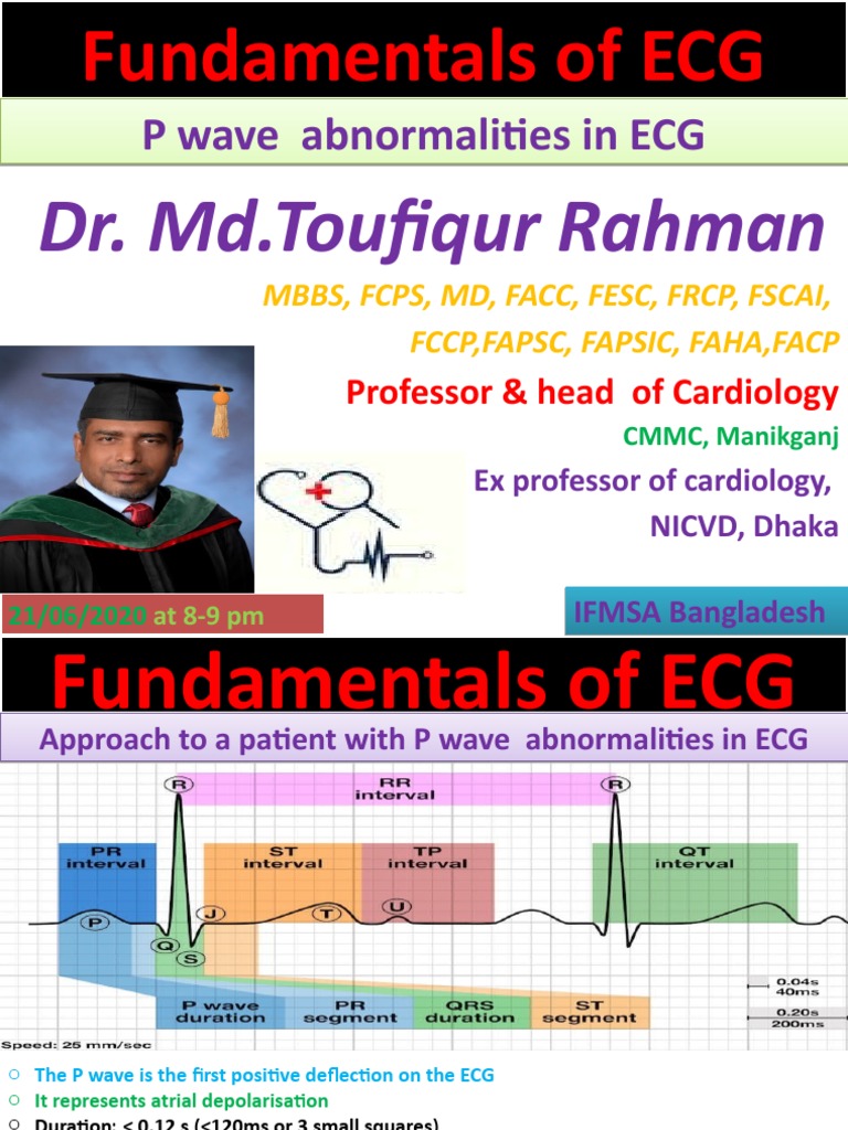 P Wave Abnormalities in ECG Analysis | PDF | Electrocardiography ...