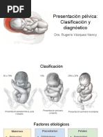 Distocia Funicular | PDF | Parto | Feto