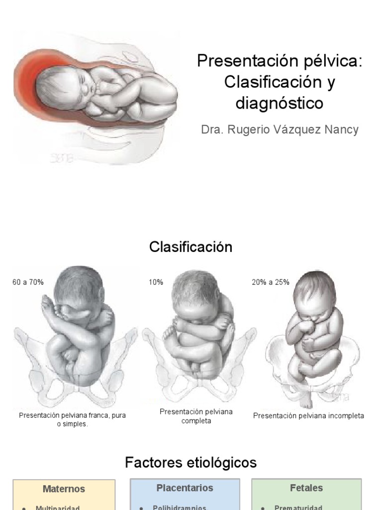 Mecanismo de Trabajo de Parto de Presentación Pelvica | PDF | Parto ...