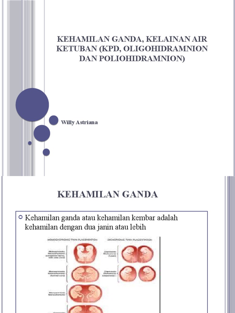 Kehamilan Ganda, Kelainan Air Ketuban (KPD, Oligohidramnion Dan Poliohidramnion) | PDF