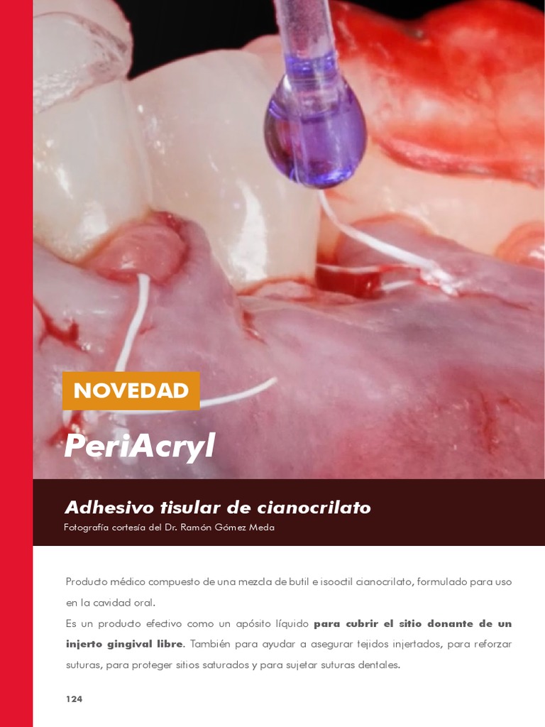 Periacryl | PDF