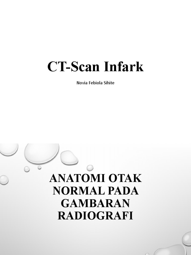 CT Scan Infark Dan Perdarahan Otak | PDF