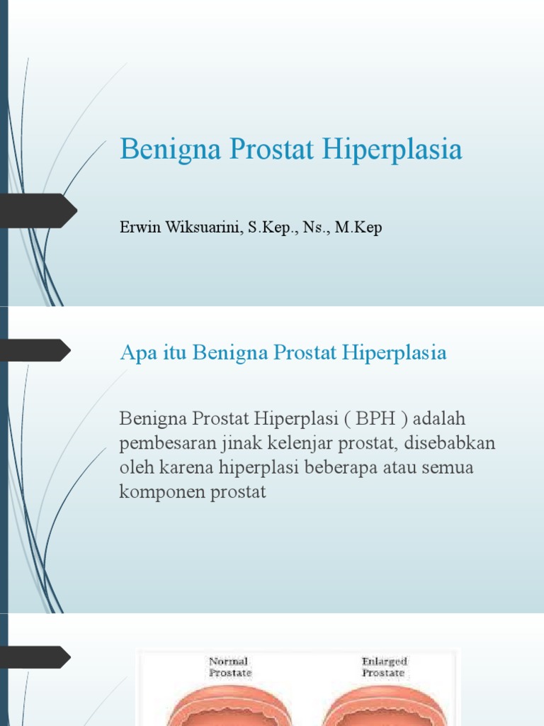 Benigna Prostat Hiperplasia | PDF | Pengembangan Diri | Kesehatan Holistik