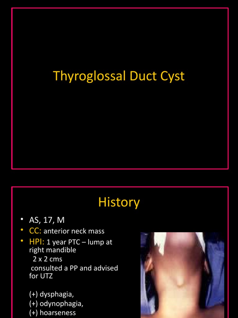 Thyroglossal Duct Cyst | PDF | Human Head And Neck | Organ (Anatomy)