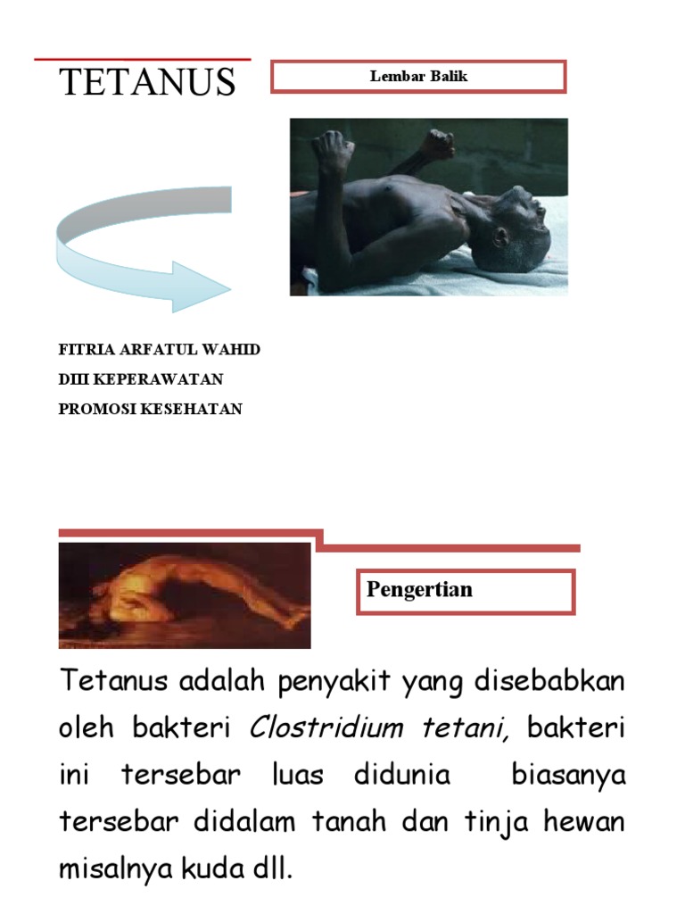 Lembar Balik Tetanus 1 | PDF | Kesehatan Holistik
