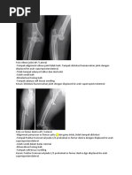 Radiologi Expertise Tulang | PDF