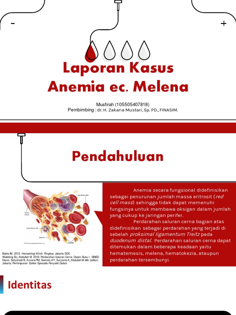 Lapsus Non Trauma-Anemia Ec. Melena | PDF
