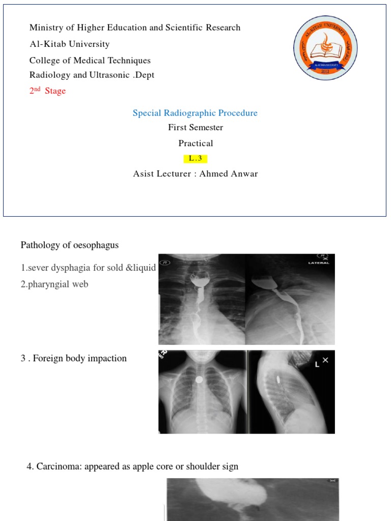 Pathology of Oesophagus - Stomach Practicle | PDF