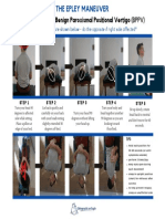 Epley Maneuver Instructions for Left Ear | PDF | Physical Therapy