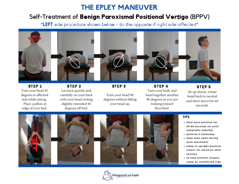 Self-Treatment of Benign Paroxismal Positional Vertigo (BPPV) | PDF