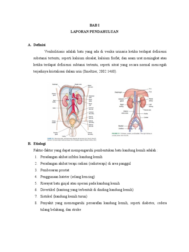 VESICOLITHIASIS | PDF