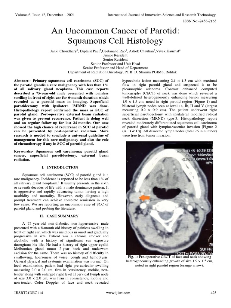 An Uncommon Cancer of Parotid Squamous Cell Histology | PDF ...