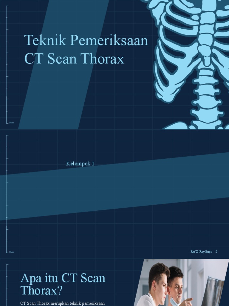 Kelompok 1 (Teknik Pemeriksaan CT Scan Kepala) | PDF