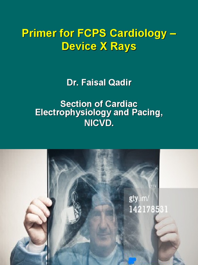 FCPS Cardiology Device X Rays Guide | PDF | Science & Mathematics ...