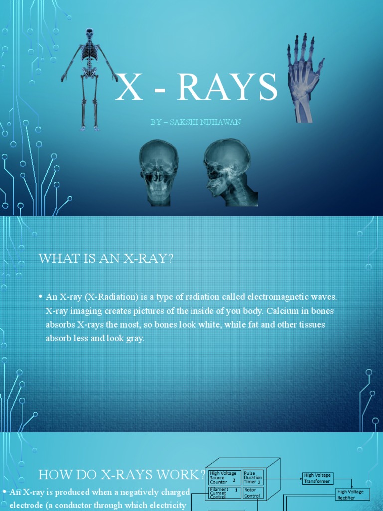 X-Ray Basics: What You Need to Know | PDF | X Ray | Vacuum Tube