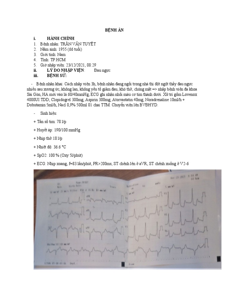 Bệnh Án Cấp Cứu Nmct | PDF