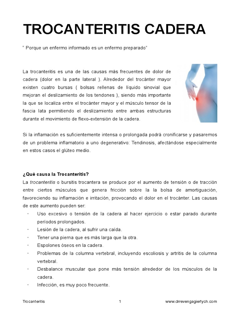 Guía Completa sobre Trocanteritis | PDF | Medicina | Especialidades Medicas