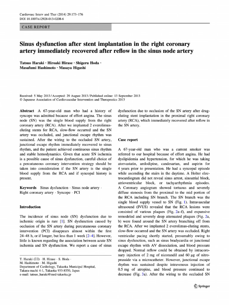 Sinus Node Dysfunction and Ischemia | PDF
