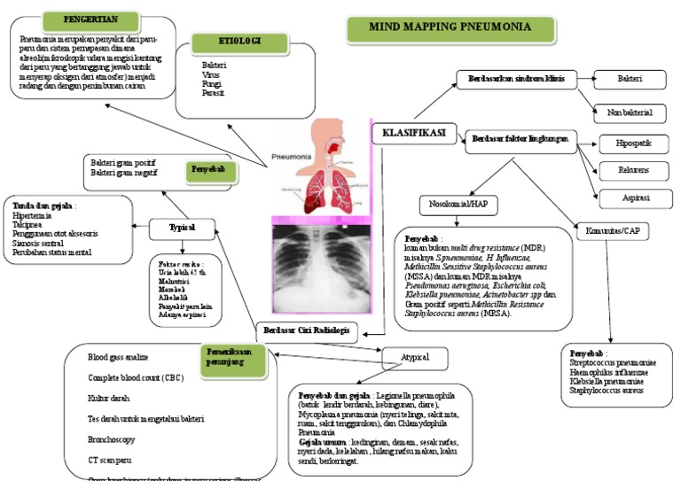 Mind Mapping Pneumonia | PDF