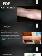 Ejemplo RX Torax Normal | PDF