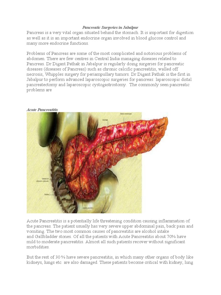 Diseases of Pancreas | PDF | Pancreas | Pancreatic Cancer