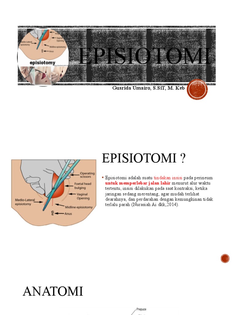 Review Teori Episiotomi | PDF