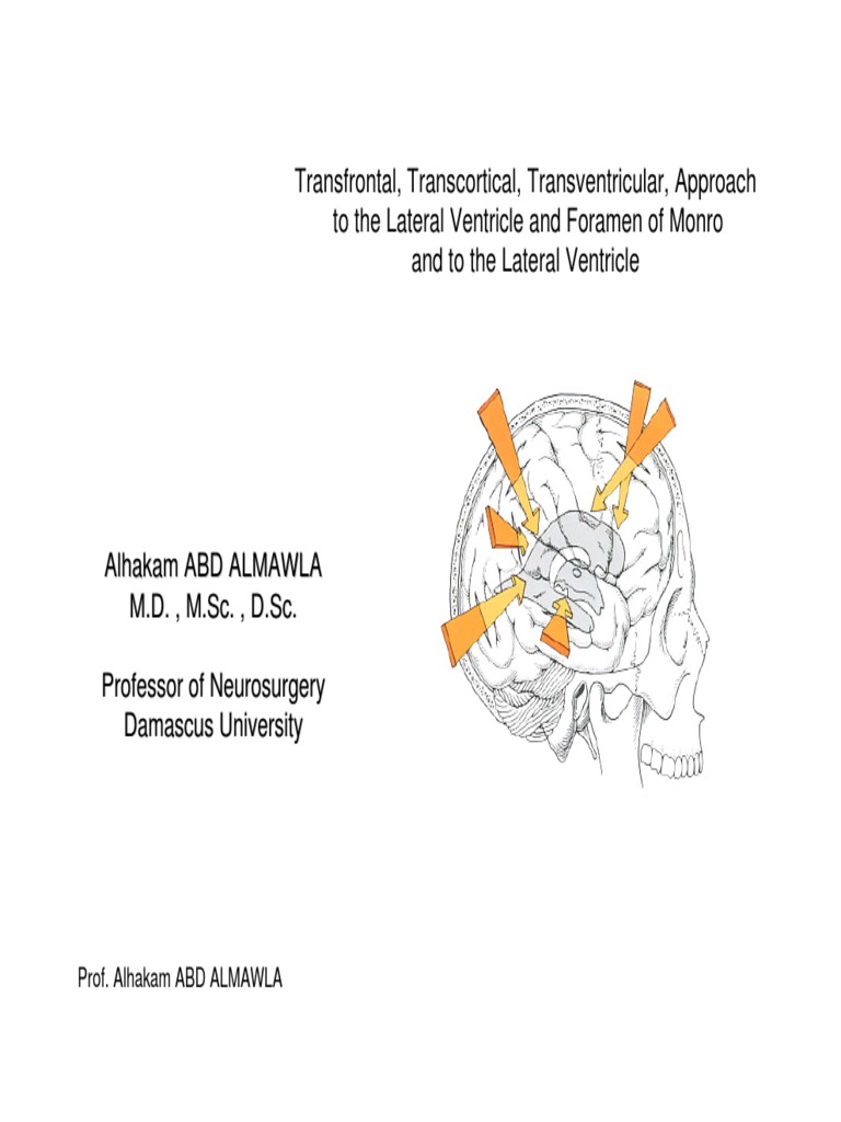 Transfrontal, Transcortical, Transventricular, Approach To The Lateral ...