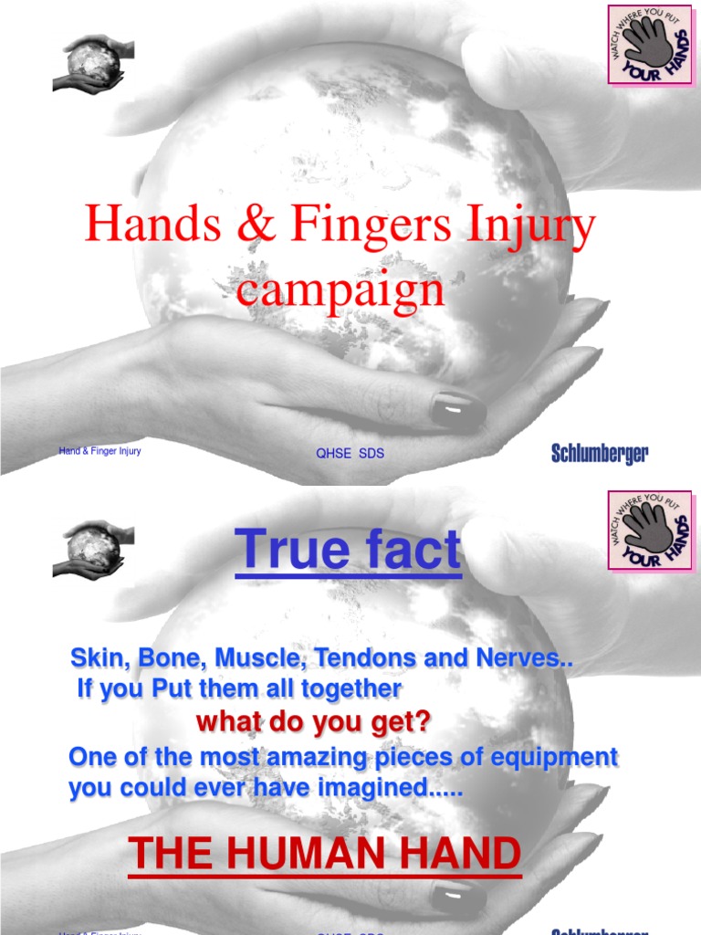 Hands & Fingers Injury Campaign | PDF | Hand | Finger