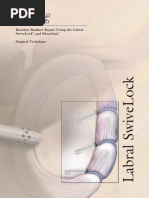 DX Knotless Fibertak Anchor | PDF | Surgical Suture | Medical Specialties
