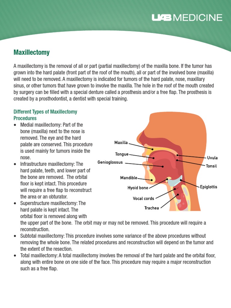 Maxillectomy: Different Types of Maxillectomy Procedures | PDF ...