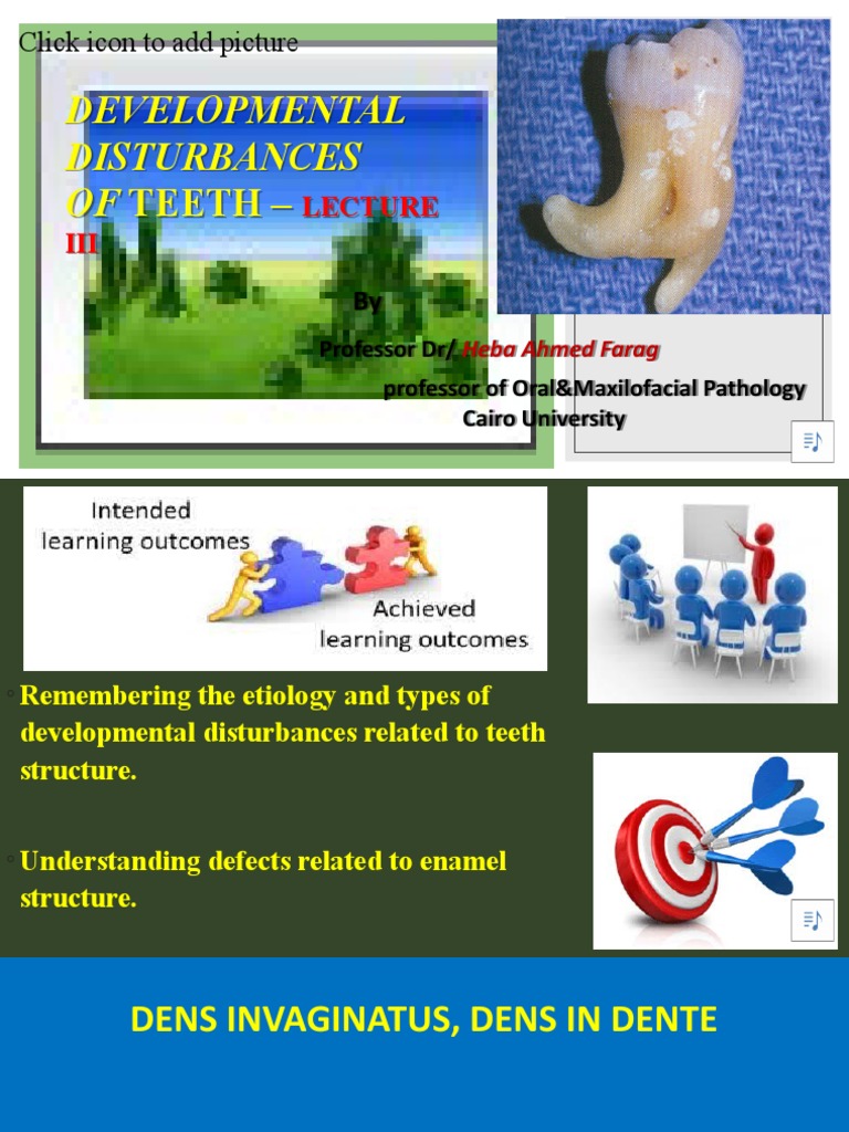 3-Pro-Developmental Disturbances of Teeth | PDF | Tooth Enamel | Tooth