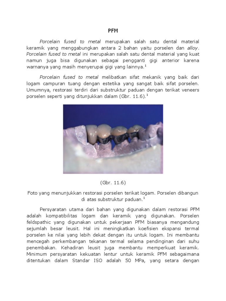 Restorasi Gigi PFM | PDF